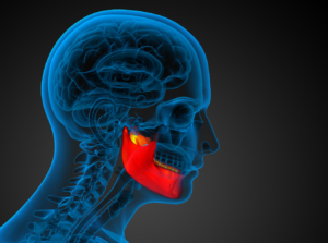 Jaw Fractures from Automobile Collisions | Maginnis Howard